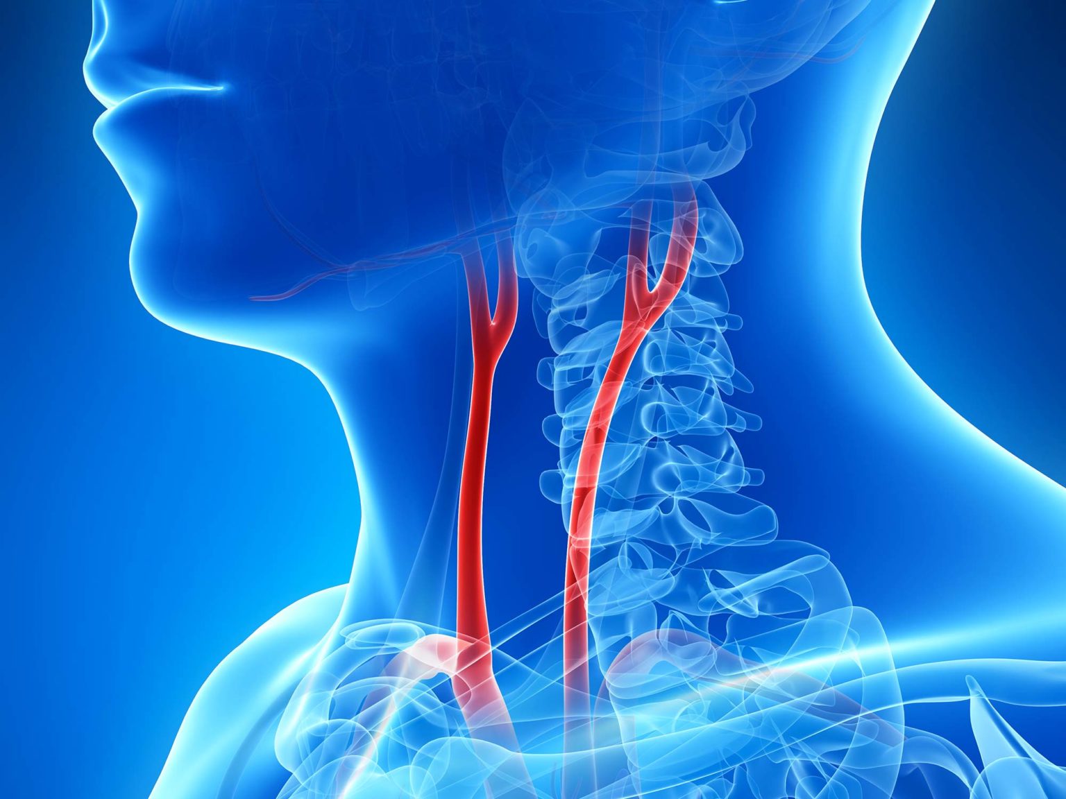 Sténose carotidienne | Chirurgie vasculaire et endocrinienne